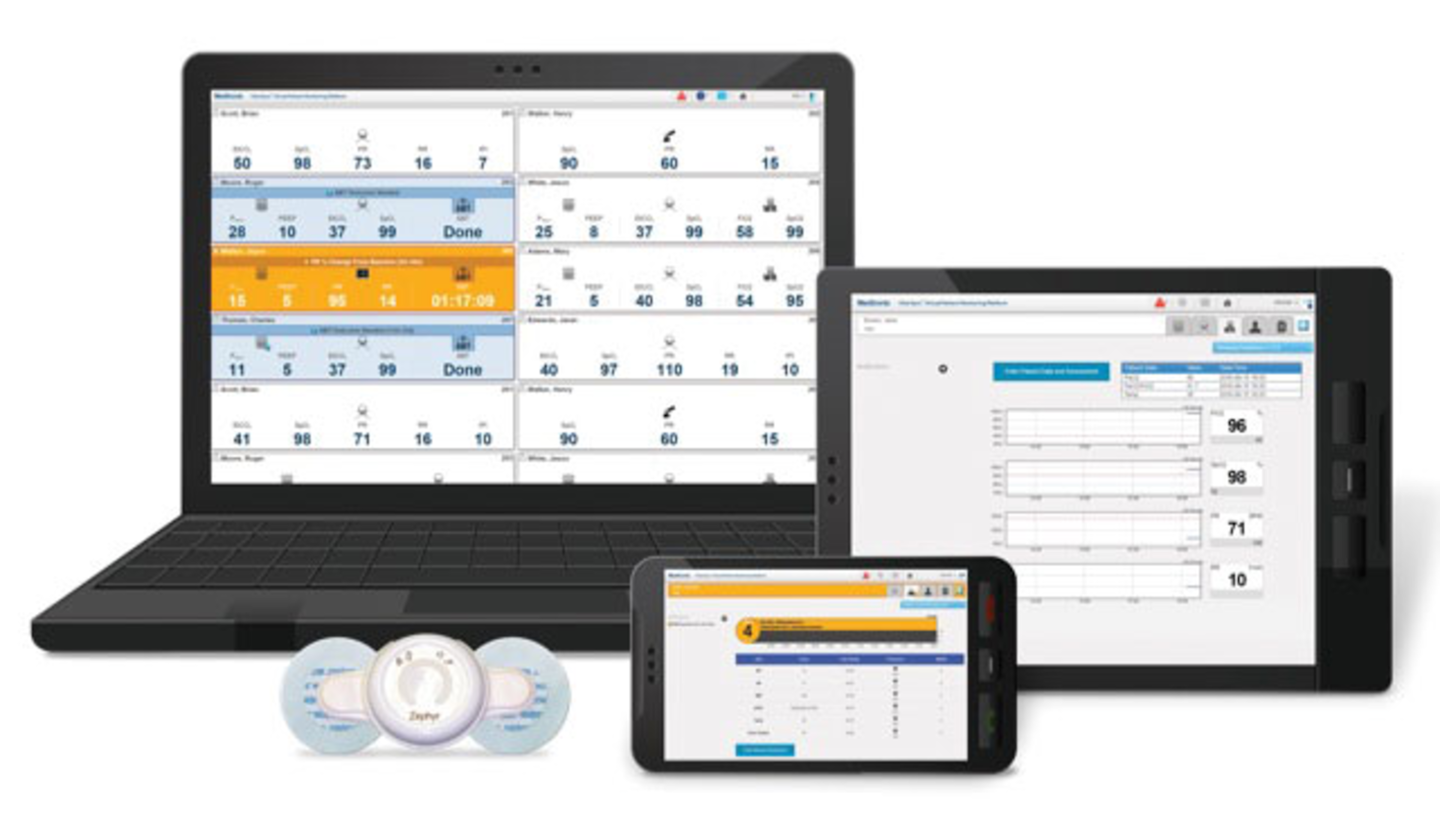 Patient monitoring – TMI? | Healthcare Purchasing News