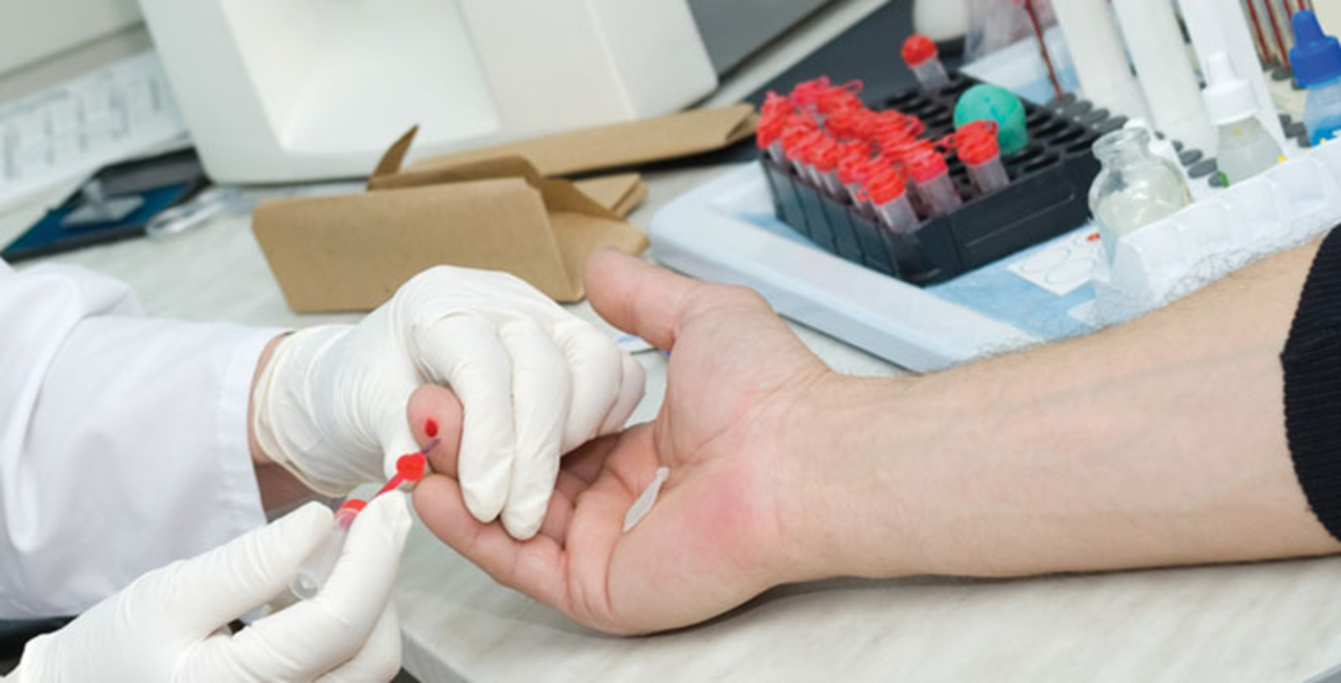 The acceleration of infection detection | Healthcare Purchasing News