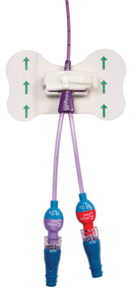 Catheter-care trifecta: compliant, cost-effective, innovative ...