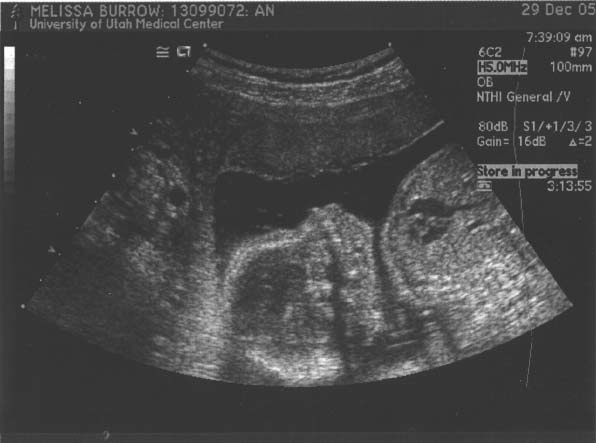 CAE Healthcare releases ultrasound simulator for 3-D/4/D heart imaging ...