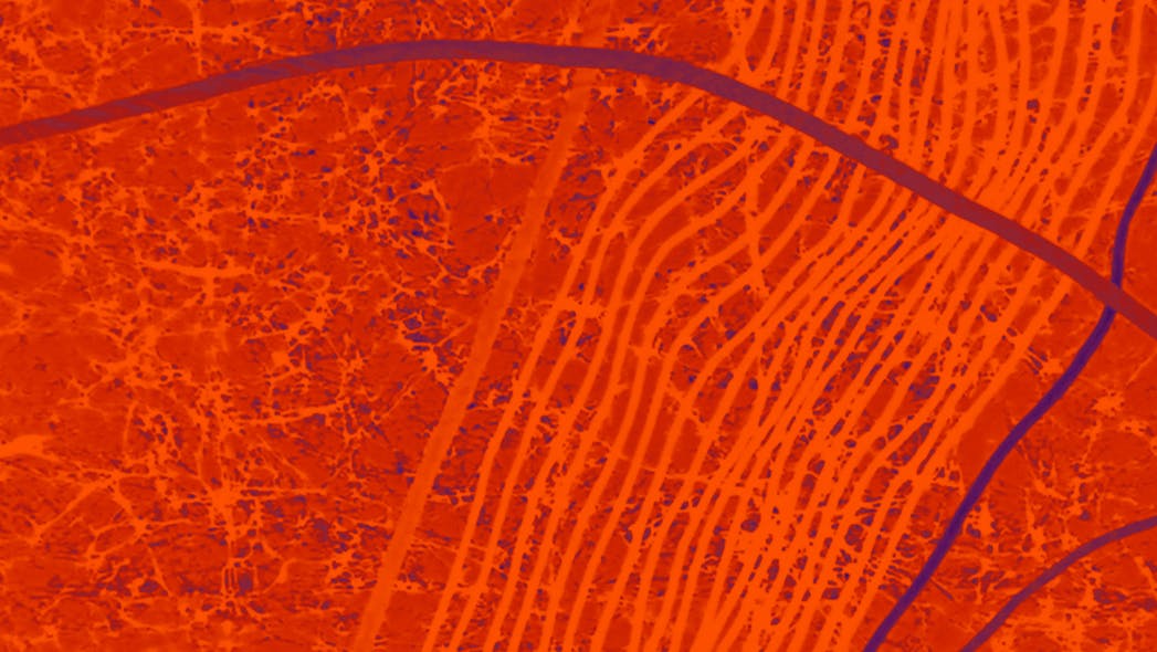 Getinge introduces Advanta V12 balloon expandable covered stent in ...