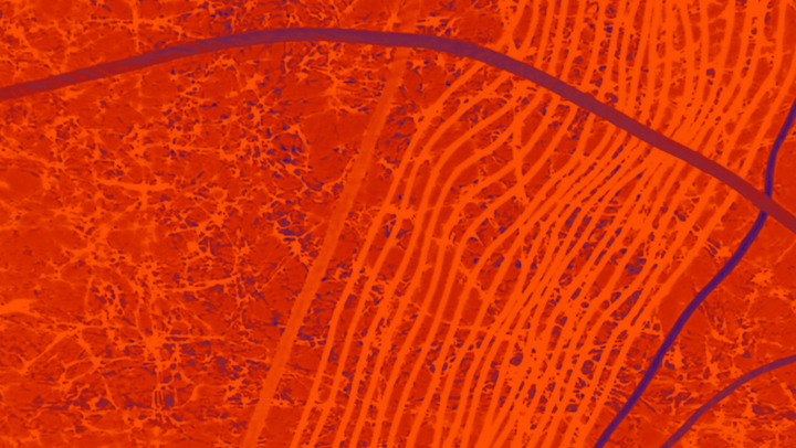 Getinge introduces Advanta V12 balloon expandable covered stent in ...