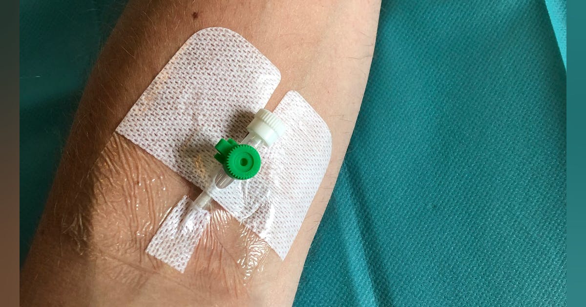 Optimal Dressing Securement Of Peripheral Iv Catheters Optimal Dressing Securement Of Peripheral Iv Catheters