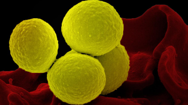 Staphylococcus aureus bacteremia antibiotic trial starts | Healthcare ...