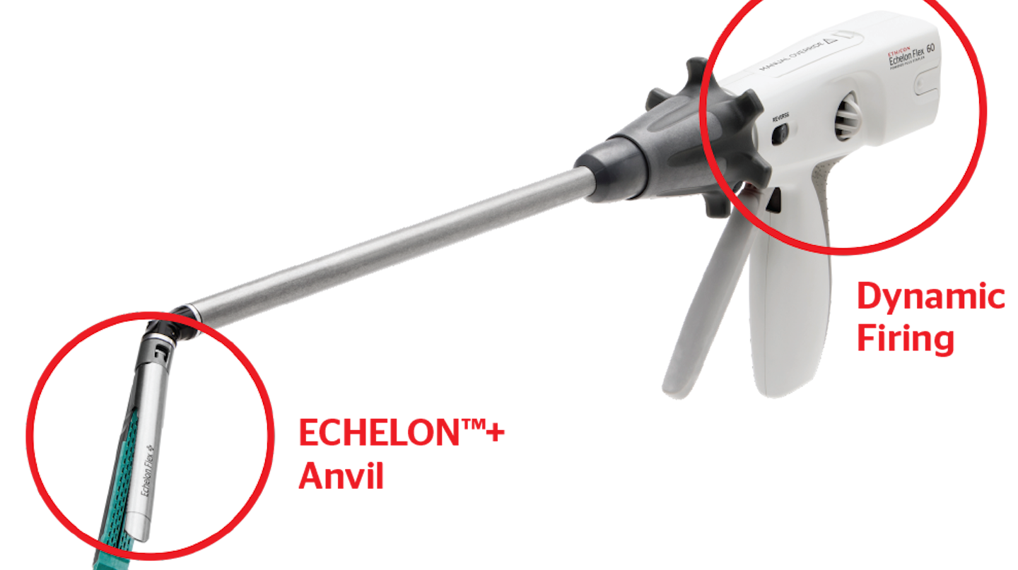 Surgical stapler increases staple line security, reduces complications ...