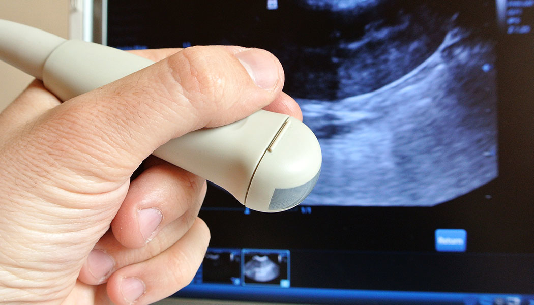 Surveyors probe ultrasound device HLD practices | HPN Online