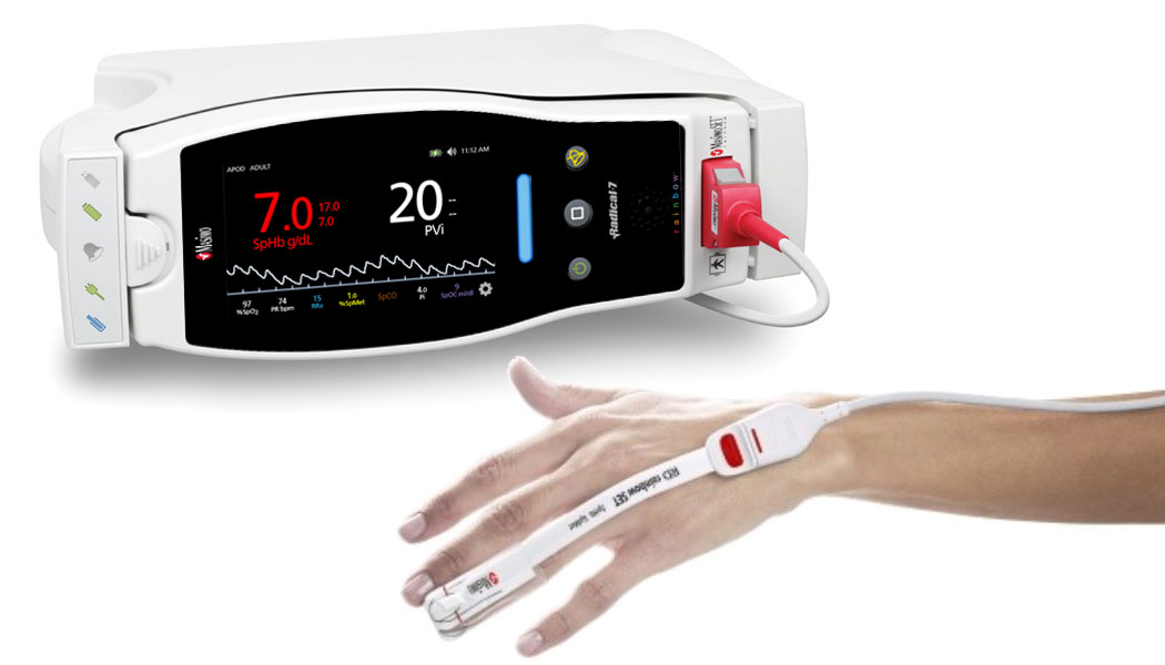 Positive finding on hemoglobin monitoring in postoperative pediatric ...