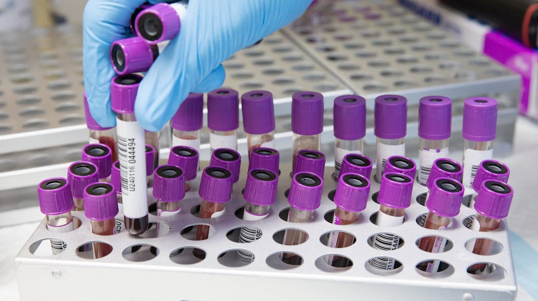 The less blood the better in pediatric intensive care | Healthcare ...