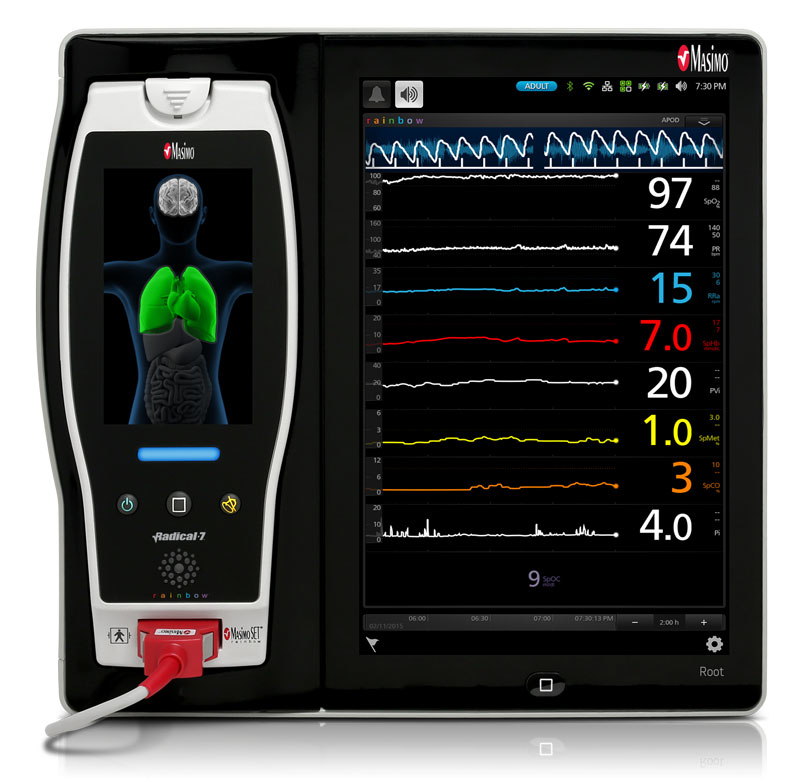 Scope and scale of patient monitoring | Healthcare Purchasing News