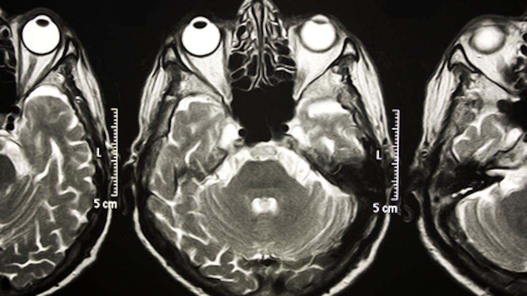 Philips announces advances in imaging for head and neck cancers ... Philips announces advances in imaging for head and neck cancers ...