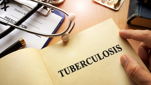 WHO stepping up to combat tuberculosis | Healthcare Purchasing News