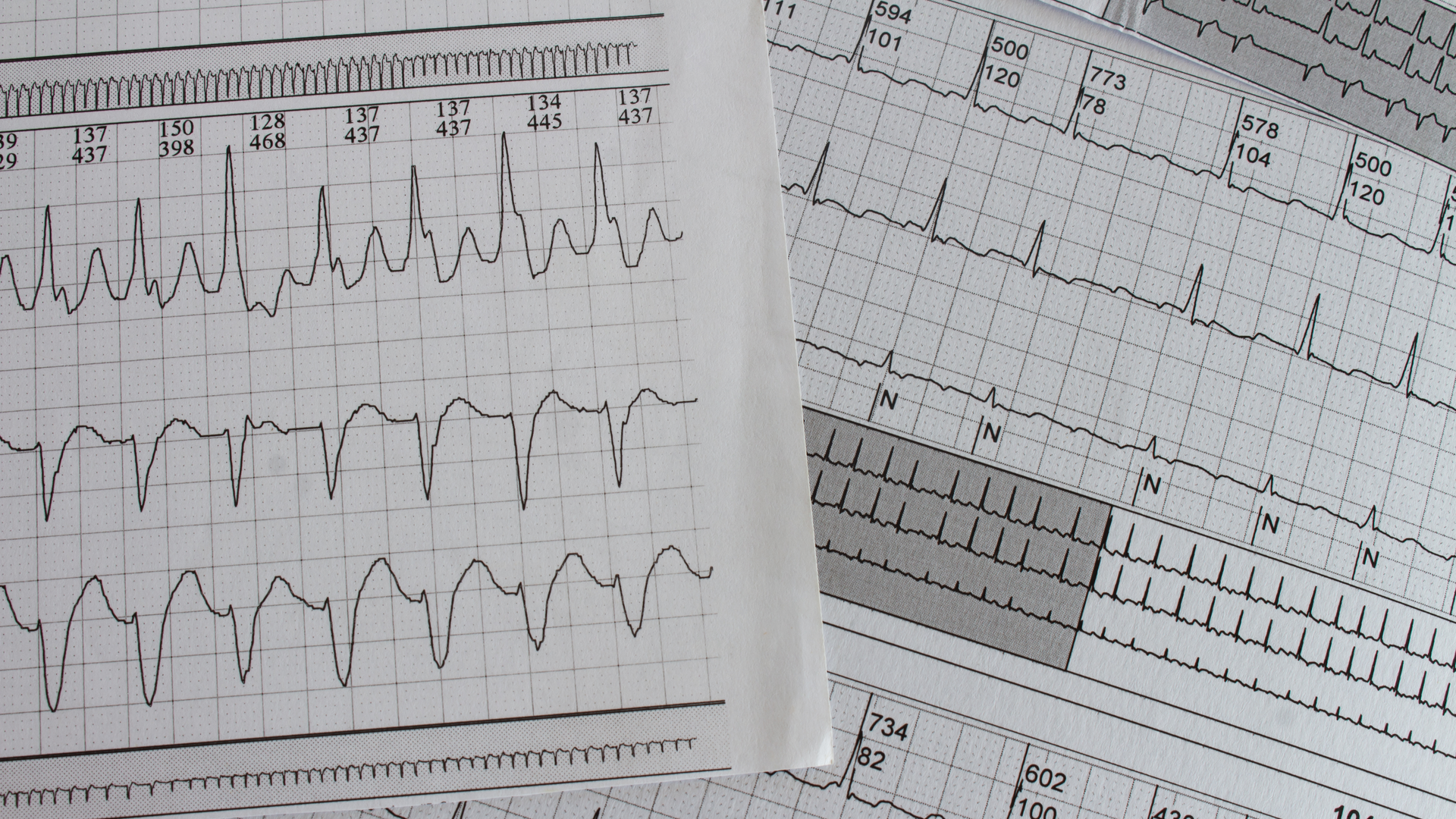 Tool helps better manage atrial fibrillation and comorbidities | HPN Online