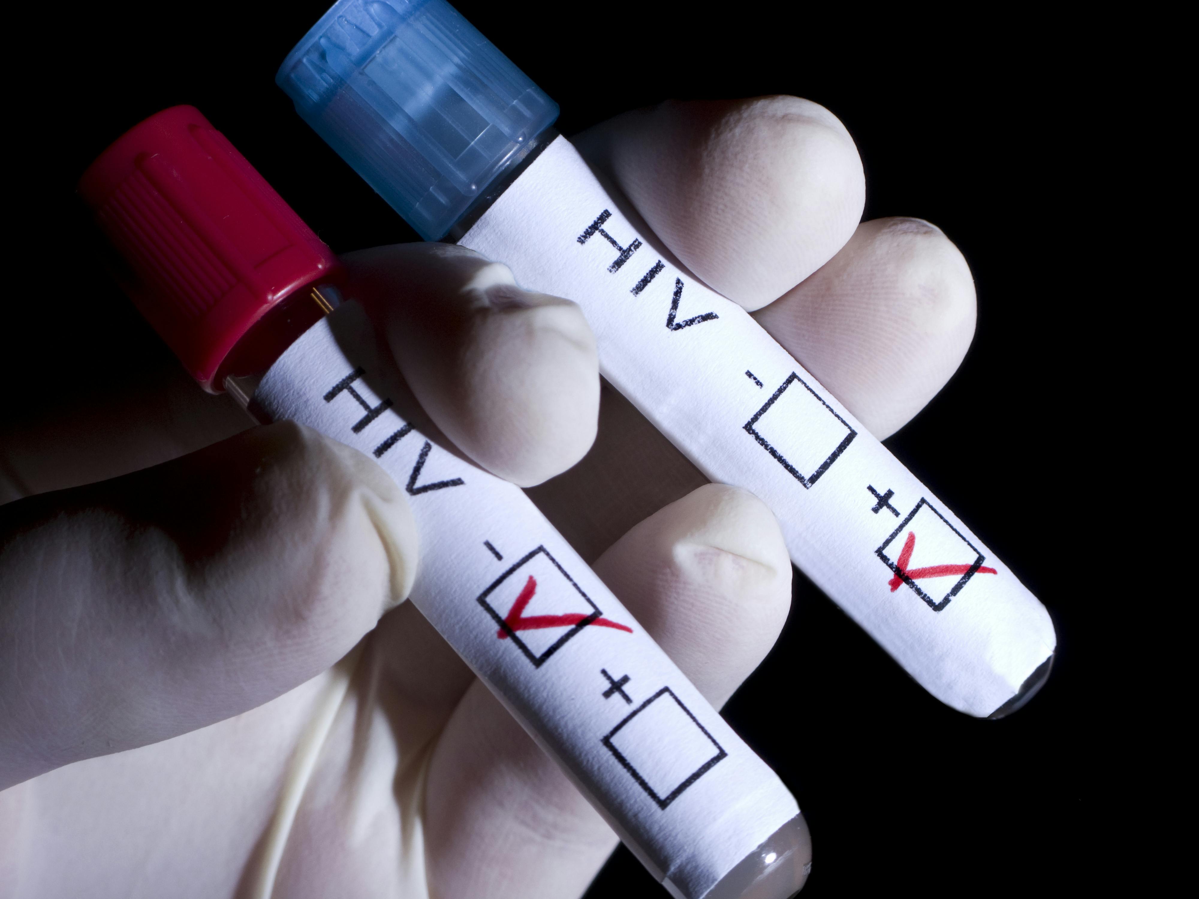 HIV Patient in Germany Announced Virus-Free After Stem Cell Transplant ...